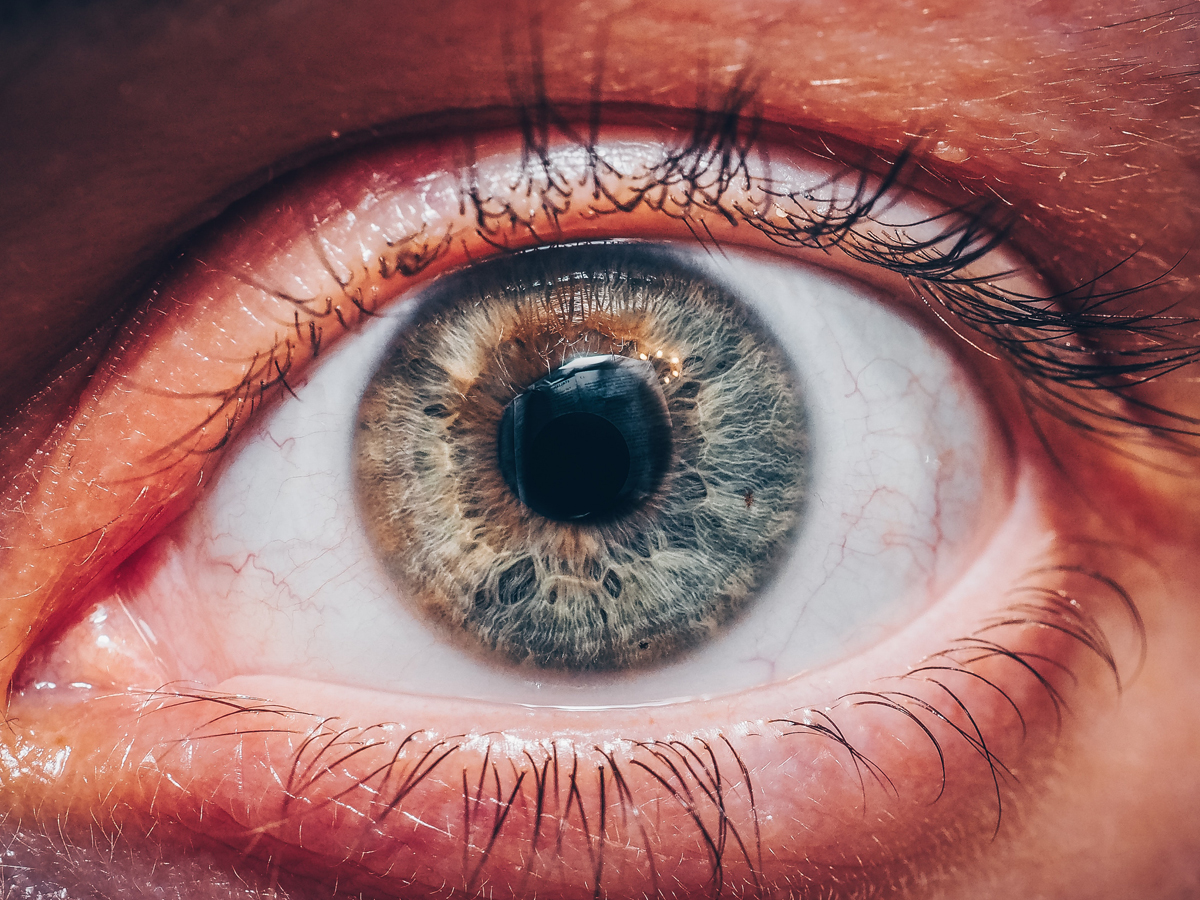 Yeux vairons : quand on a les yeux de couleur différente